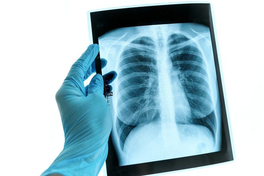 Private X Ray Luton - Fusion Radiology - Quality Tele-radiology ...